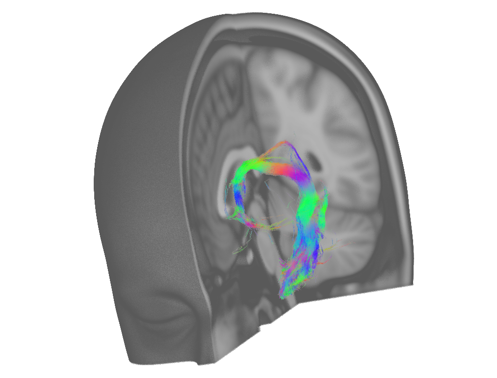 3D view — FSLeyes documentation