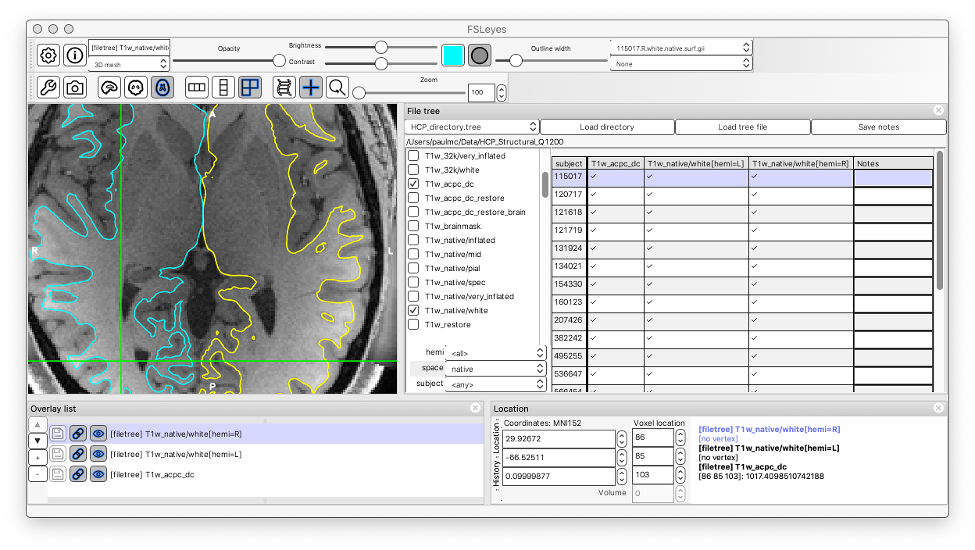 File tree — FSLeyes documentation