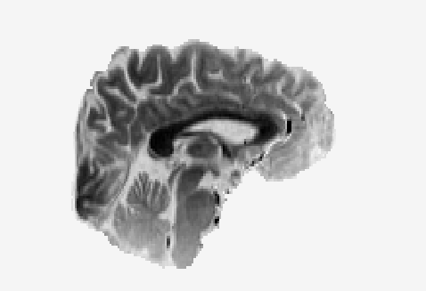 Overview — FSLeyes documentation