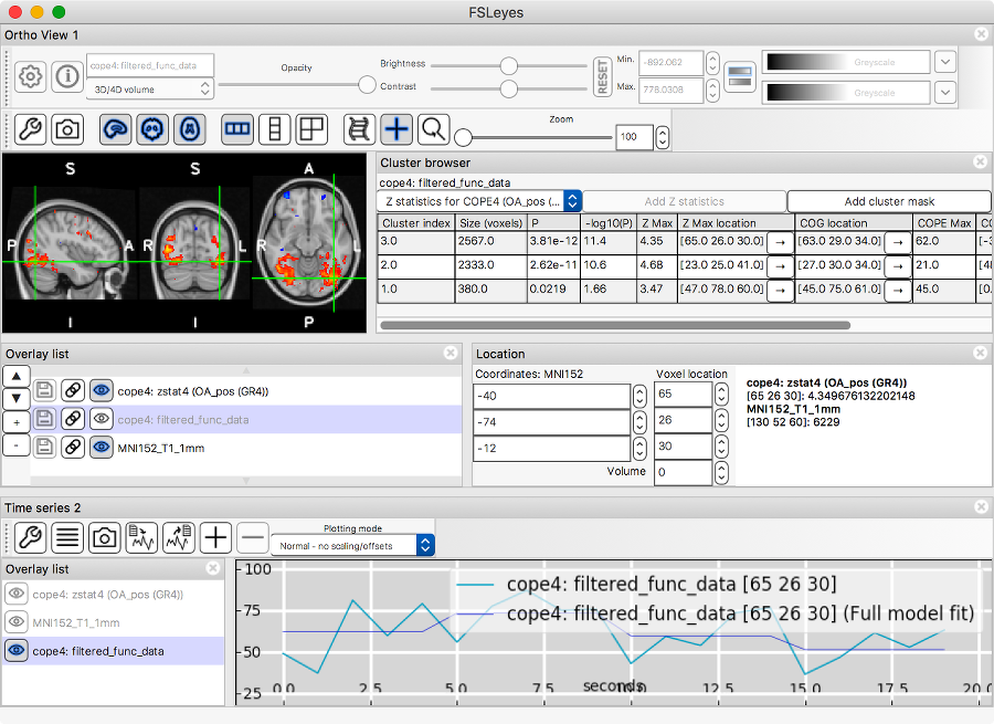 Overview — FSLeyes documentation