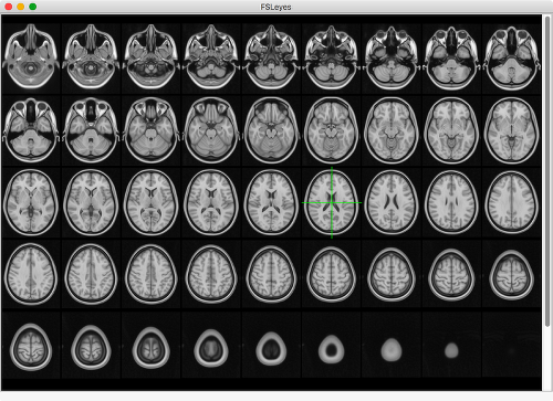 Overview — FSLeyes documentation