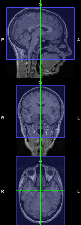 Tools — FSLeyes documentation