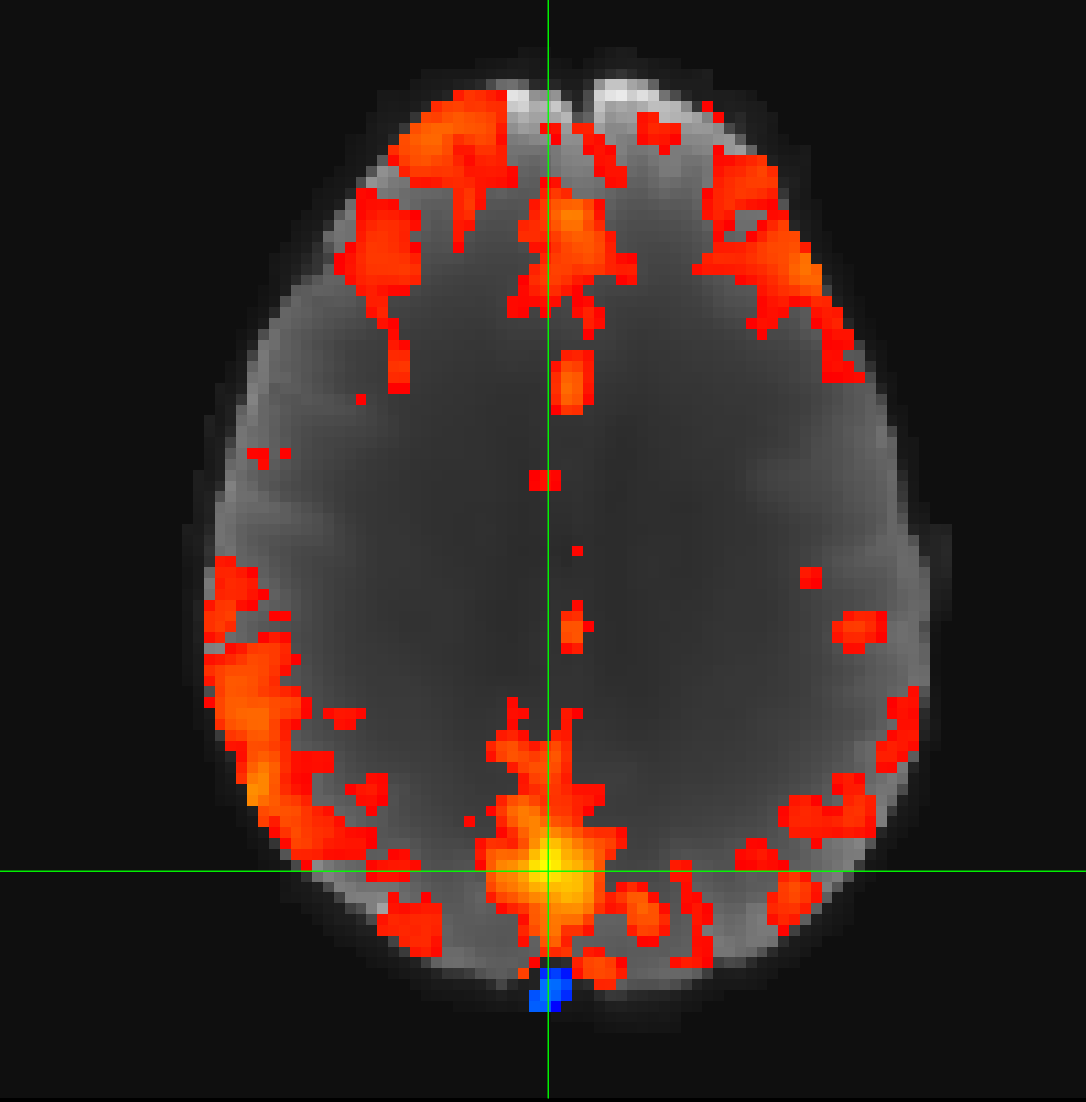 Tools — FSLeyes documentation