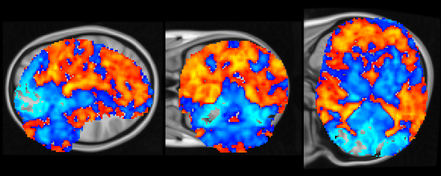 Troubleshooting — FSLeyes documentation