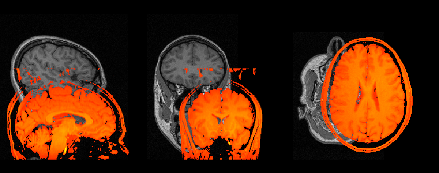 Troubleshooting — FSLeyes documentation